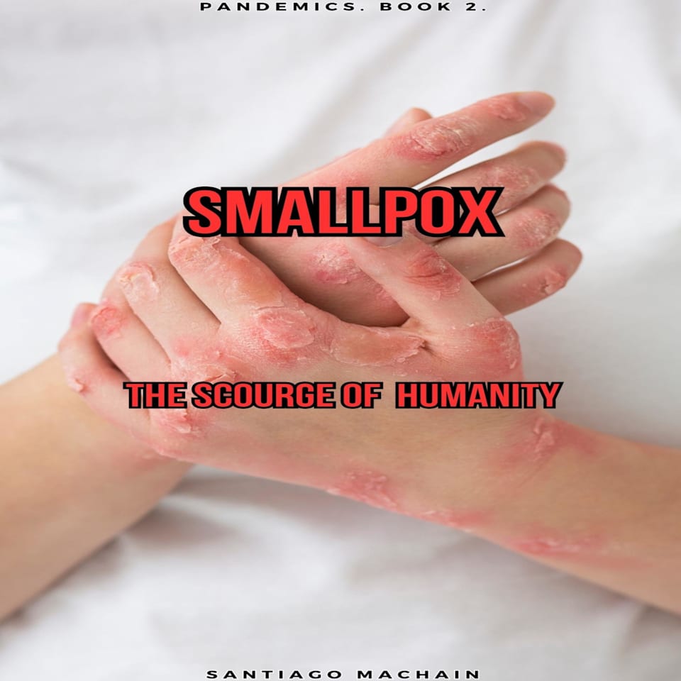 Smallpox by Santiago Machain - Audiobook